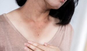 8 Proven Tips & Natural Remedies to Lighten Dark Neck Skin - Myhealthopedia