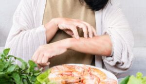 7-Day Eczema Diet Plan for Adults & Kids: Foods to Eat and Avoid