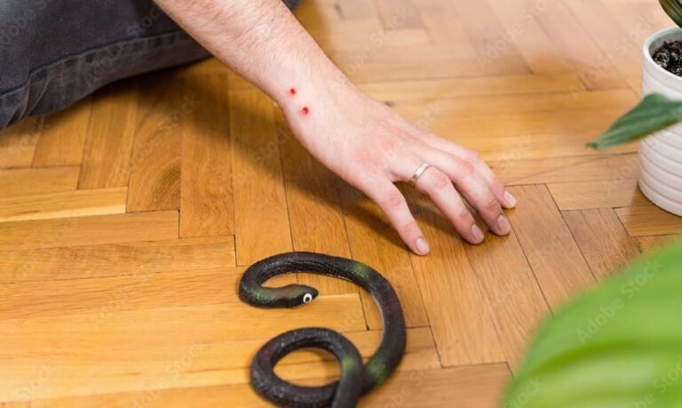Snake Bites: Types, Symptoms, First Aid, Treatment & Complications