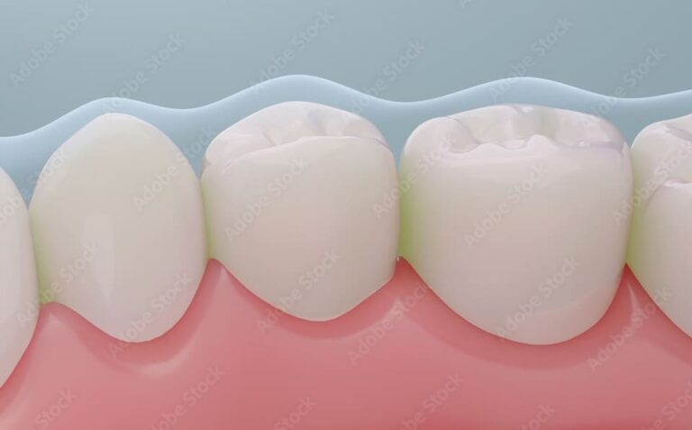 Tooth Enamel: Warning Signs, Causes of Erosion & How to Protect It